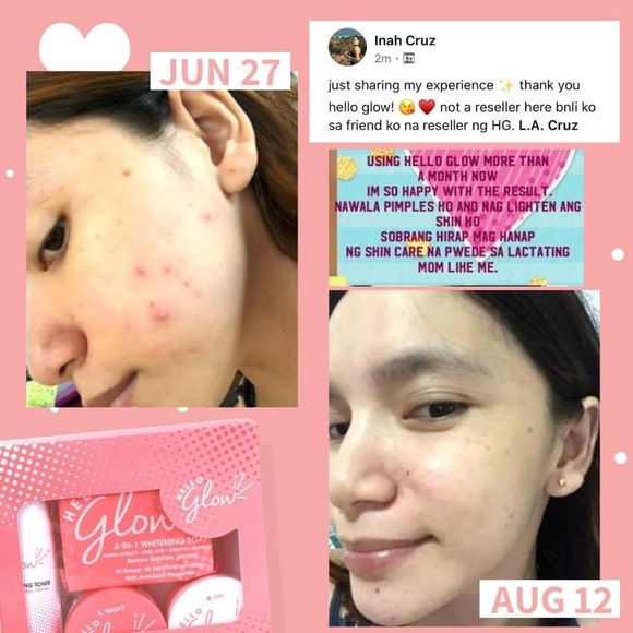Hello Glow | Skincare | Hello Glow Whitening Set | Poshmark
